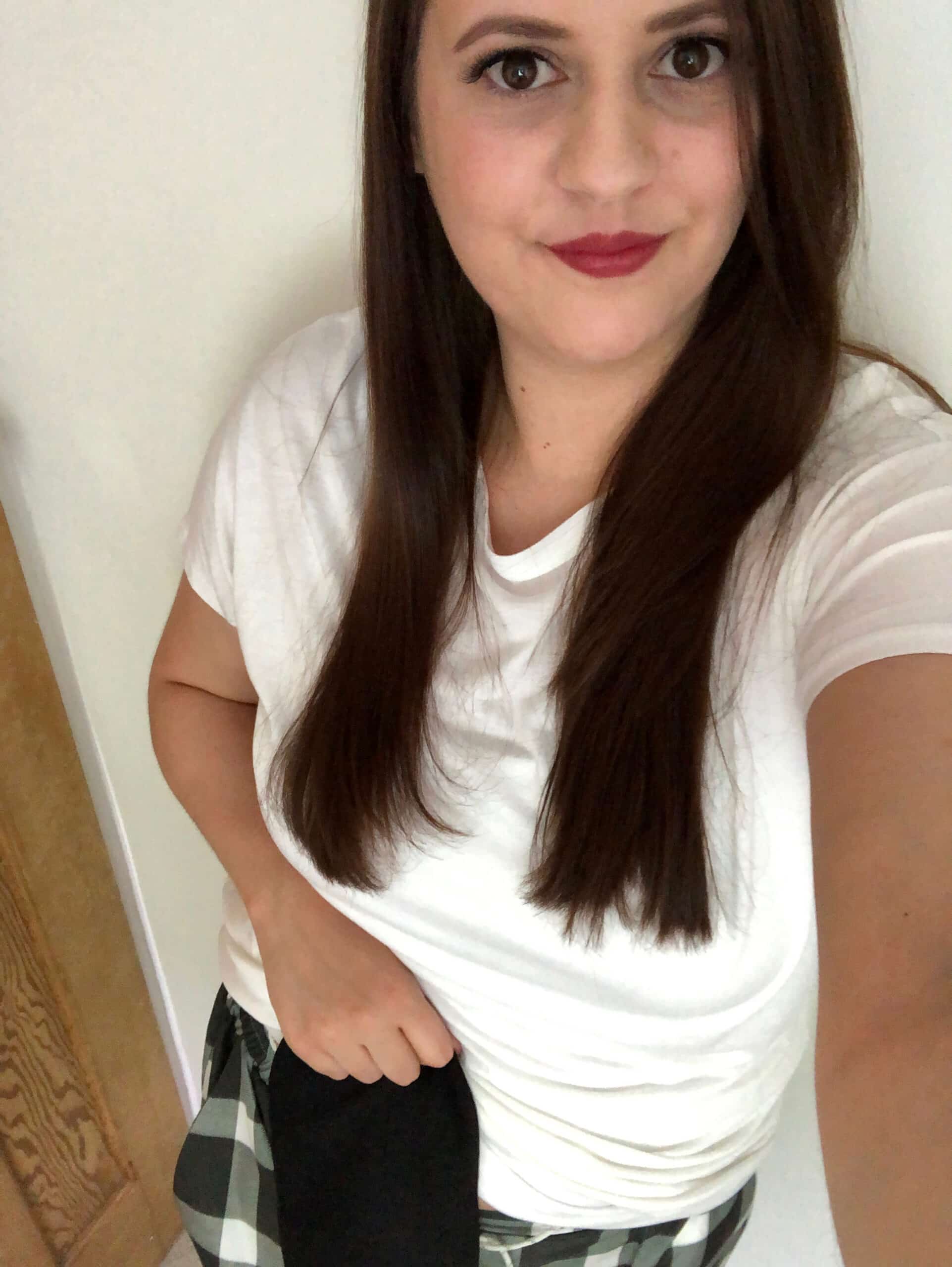 Loop Ileostomy Surgery, Six Year Update & World IBD Day